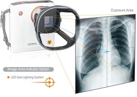 Remex ka6 raggi-x con collimatore